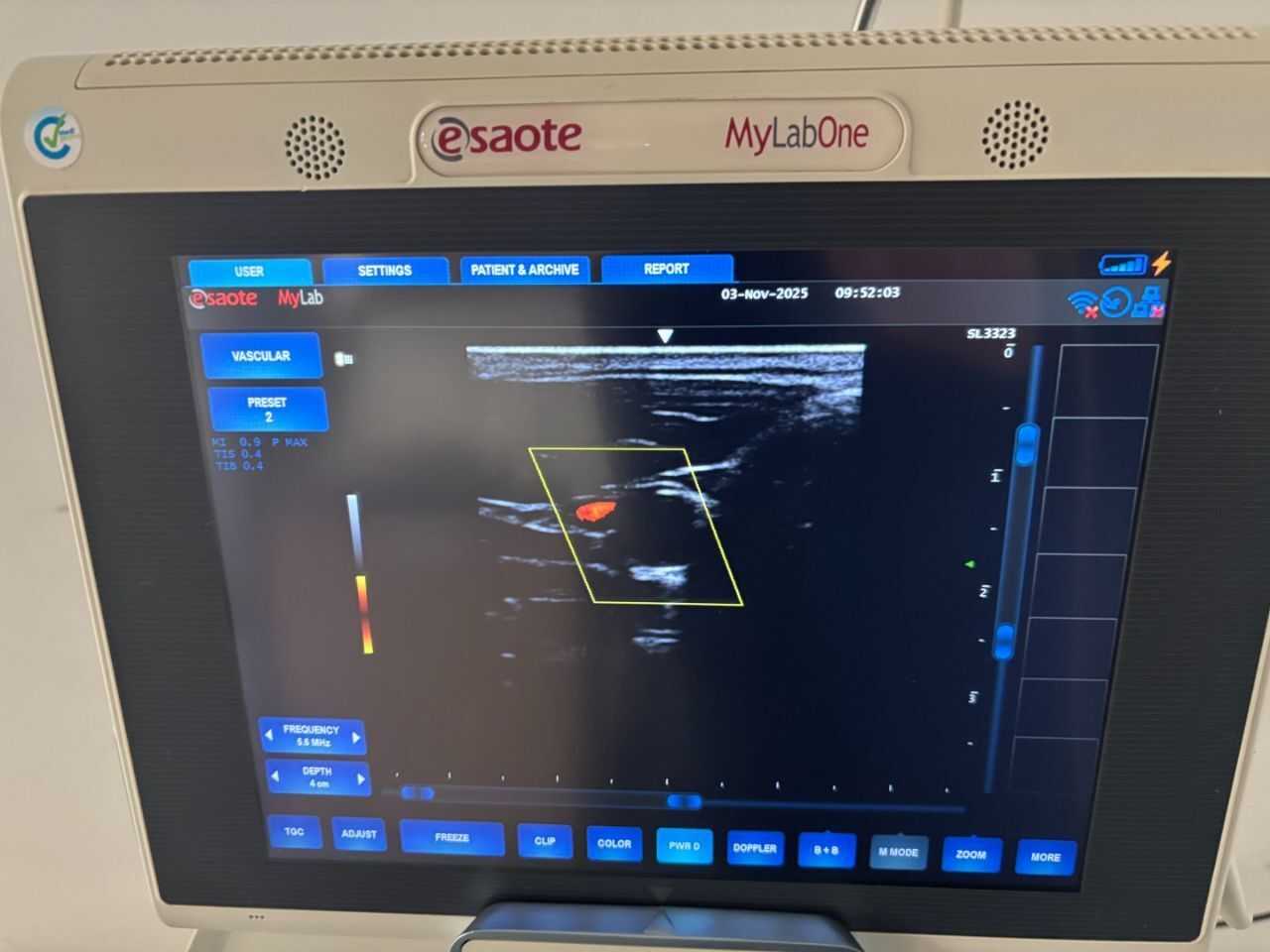 Used ESAOTE MyLab ONE Vascular - Small Parts Ultrasound For Sale ...