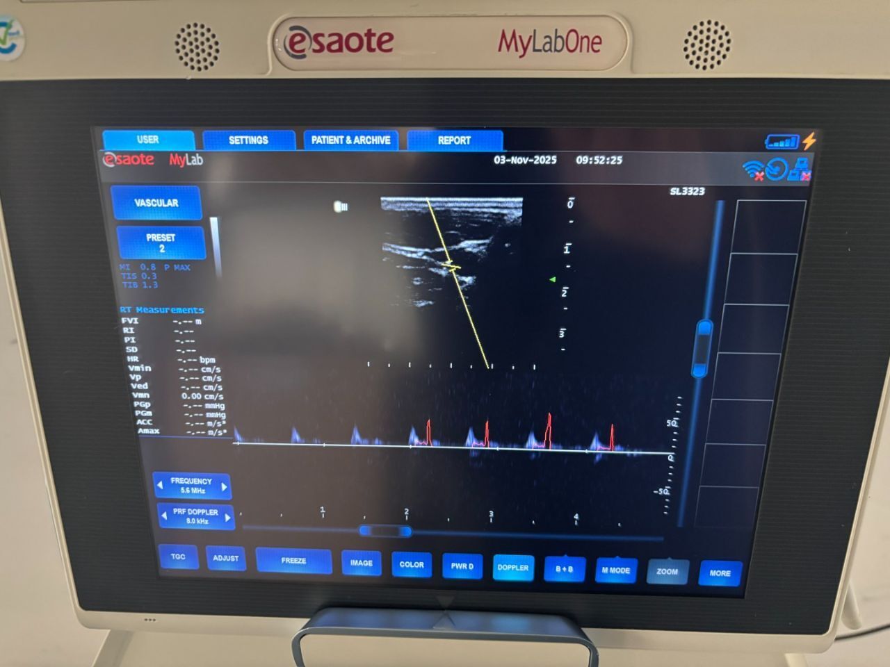 Used ESAOTE MyLab ONE Vascular - Small Parts Ultrasound For Sale ...